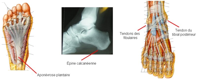 Pathologies du pied - Podosportbw